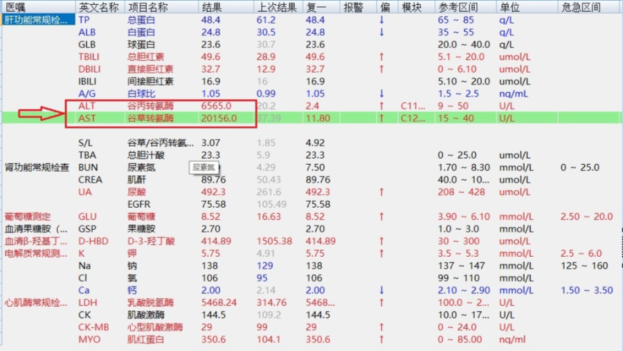 ALT和AST竟在一夜之间飙升数百倍！_医学界-助力医生临床决策和职业成长