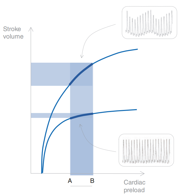 血流动力学基础：理解PPV、SVV_医学界-助力医生临床决策和职业成长
