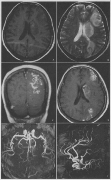 每日读懂一张影像 (2023.11.1)_医学界-助力医生临床决策和职业成长