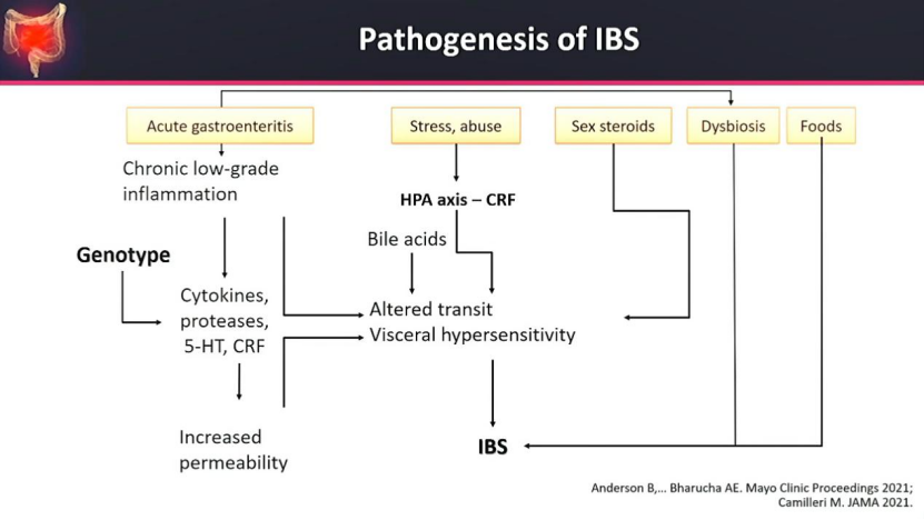 45岁女性反复腹痛、便溏3年，抗生素治疗无效，如何诊断？_医学界-助力医生临床决策和职业成长