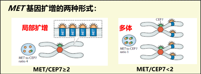 肺癌MET检测要点_医学界-助力医生临床决策和职业成长