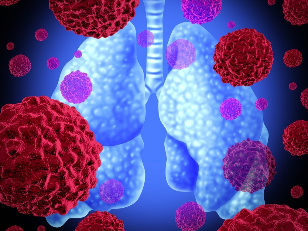 KRAS抑制剂adagrasib获FDA突破性疗法认定_医学界-助力医生临床决策和职业成长