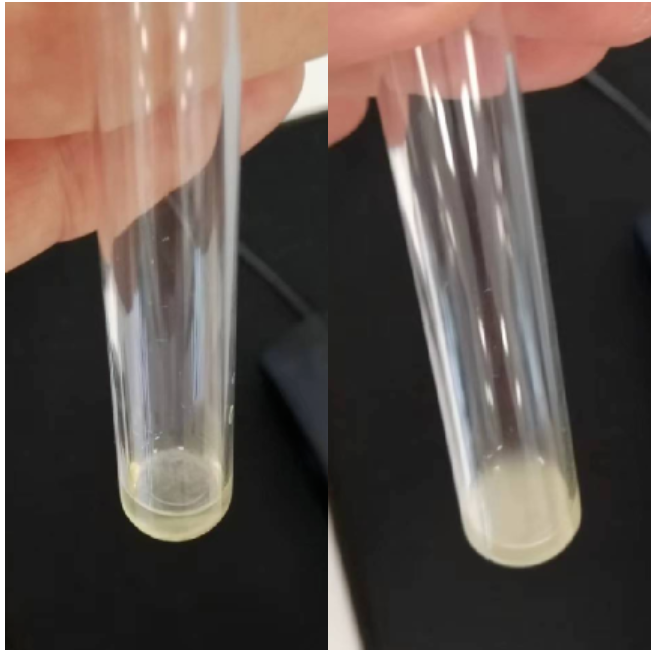 明明是骨折，APTT反应曲线却格外异常！究竟是何原因导致_医学界-助力医生临床决策和职业成长