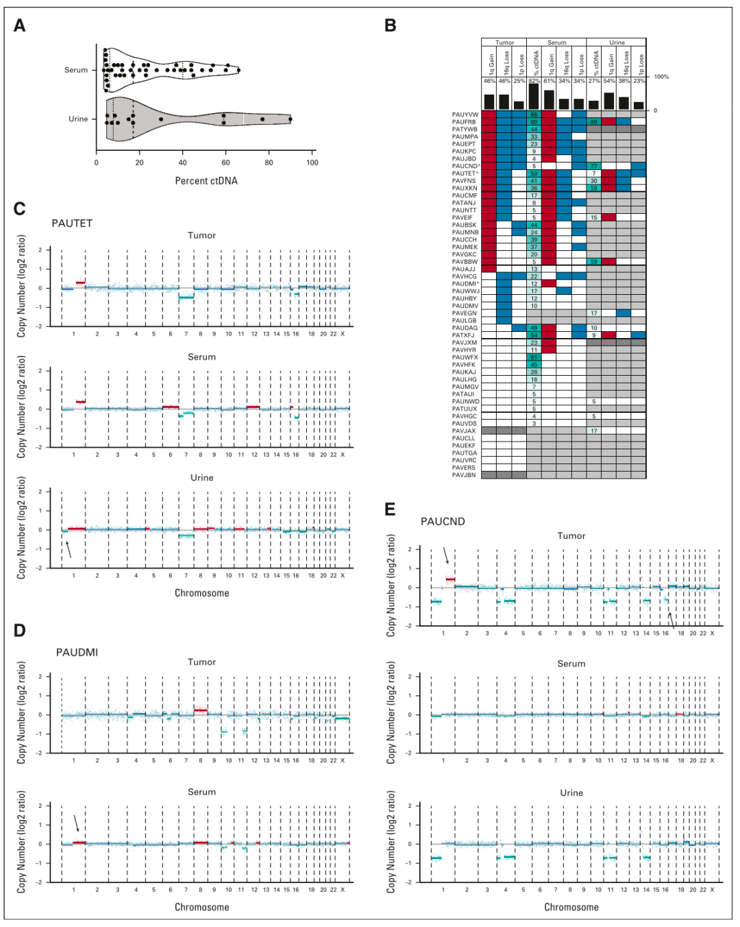 ctDNA可作为III期和IV期肾母细胞瘤的生物标志物_医学界-助力医生临床决策和职业成长