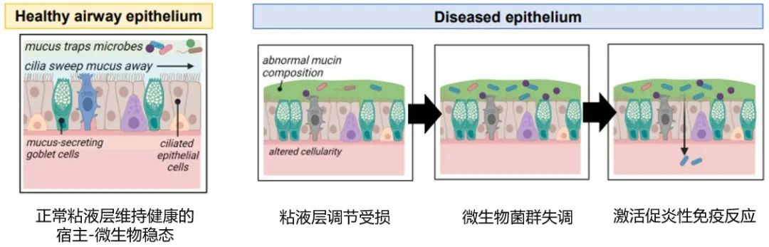 ANCA相关性血管炎的这6个新进展，你一定不想错过_医学界-助力医生临床决策和职业成长