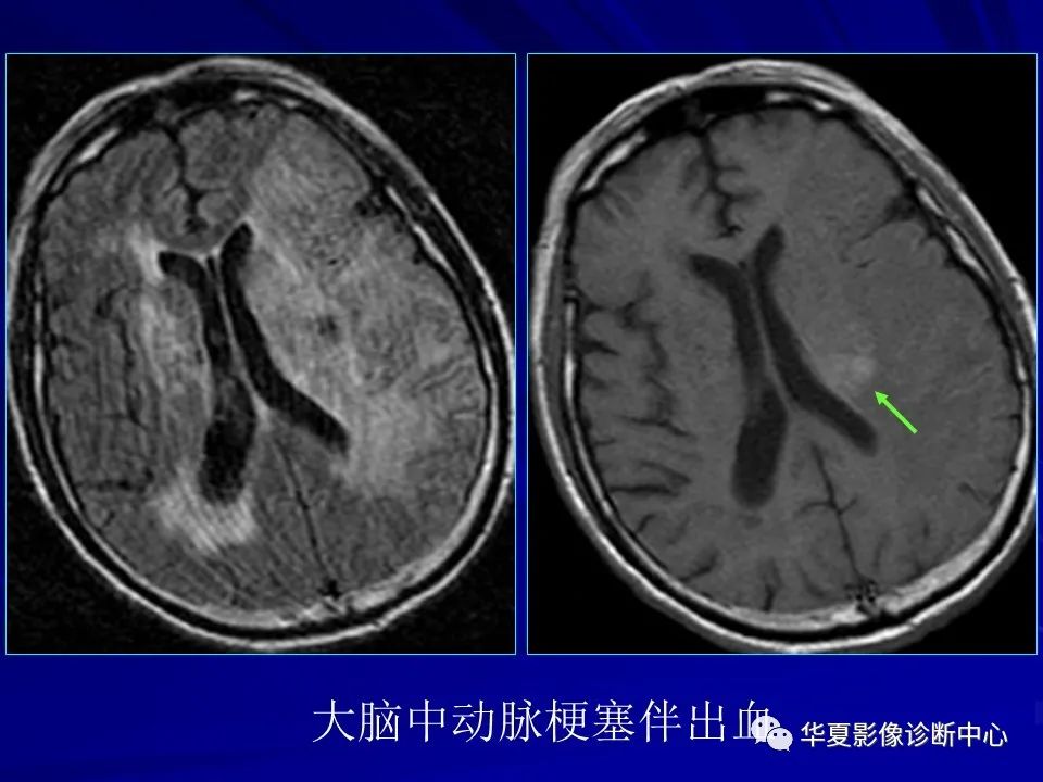 MRI临床应用解读（1）_医学界-助力医生临床决策和职业成长