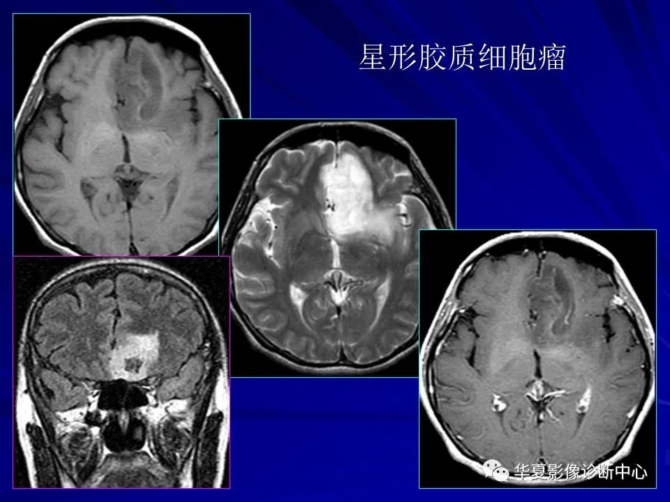 MRI临床应用解读（1）_医学界-助力医生临床决策和职业成长