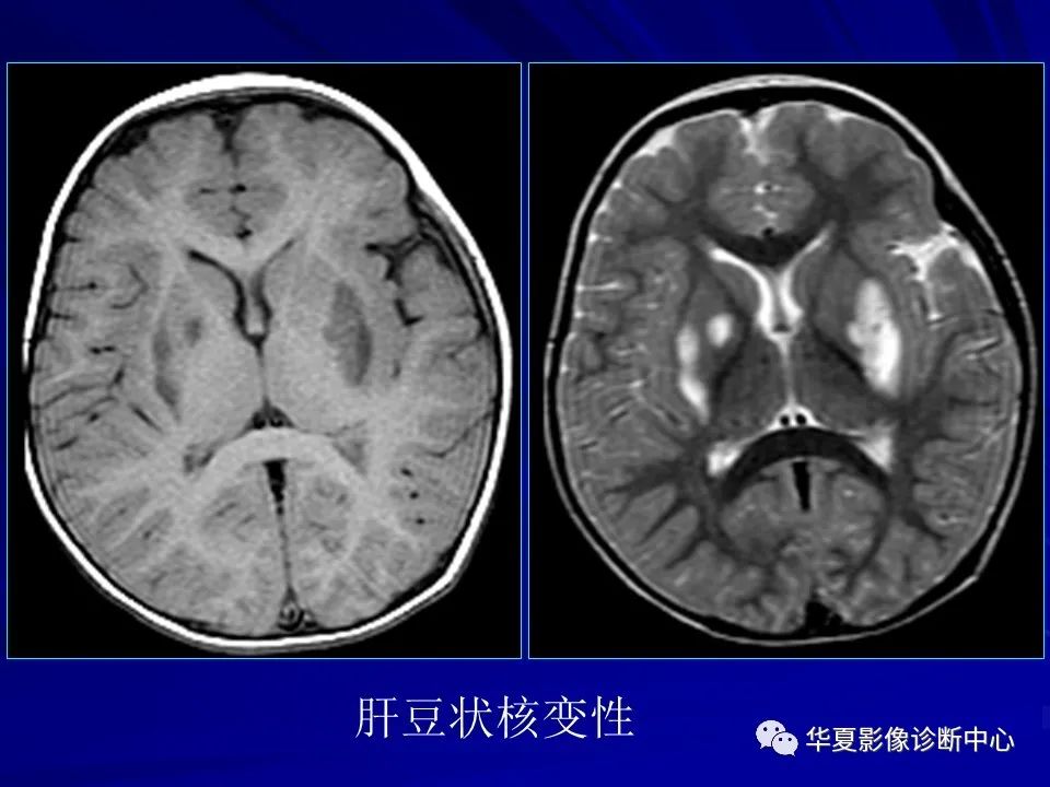 MRI临床应用解读（1）_医学界-助力医生临床决策和职业成长