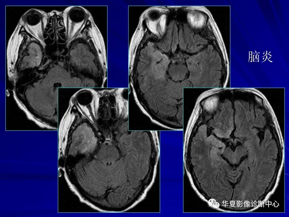 MRI临床应用解读（1）_医学界-助力医生临床决策和职业成长