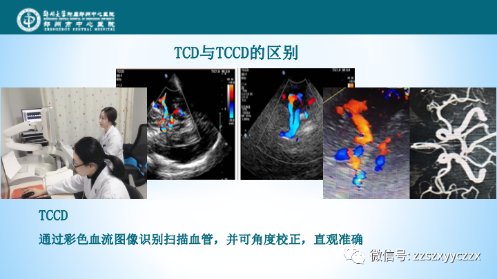 神经内科医生应该了解的 TCD及TCCD知识，一文读懂_医学界-助力医生临床决策和职业成长