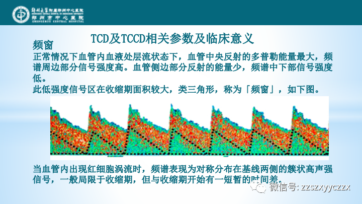 神经内科医生应该了解的 TCD及TCCD知识，一文读懂_医学界-助力医生临床决策和职业成长