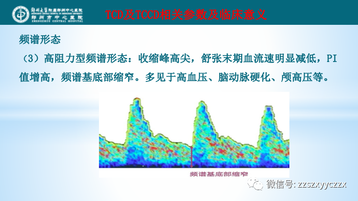 神经内科医生应该了解的 TCD及TCCD知识，一文读懂_医学界-助力医生临床决策和职业成长