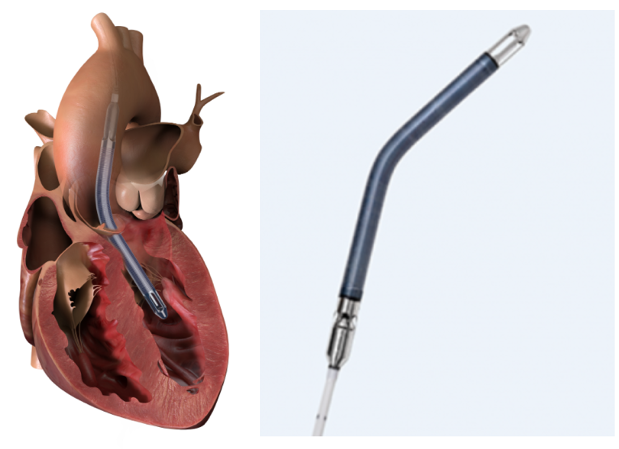 CCI创新周讯| Impella基本结构和常见并发症_医学界-助力医生临床决策和职业成长