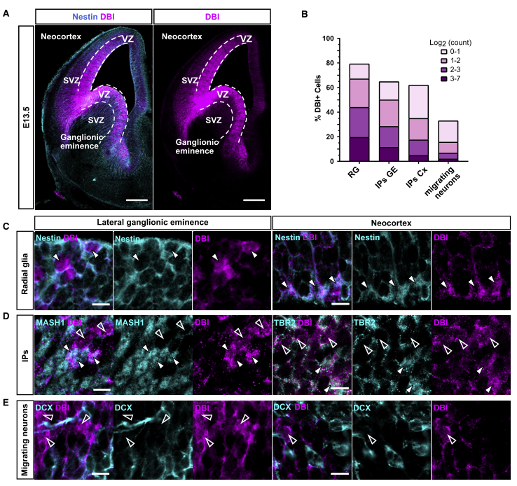 Neuron：GABA信号调控神经发生_医学界-助力医生临床决策和职业成长