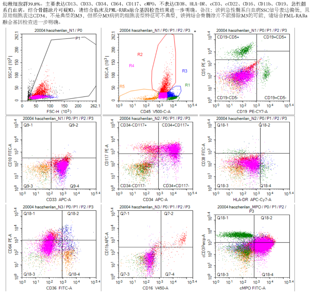治疗相关免疫分型不典型急性早幼粒细胞白血病1例_医学界-助力医生临床决策和职业成长