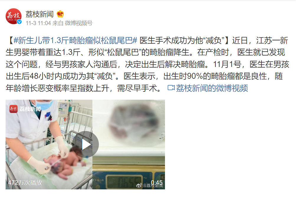 宝宝出生自带「松鼠尾巴」？医生：「恶变之前尽早切除！」医学界 助力医生临床决策和职业成长 
