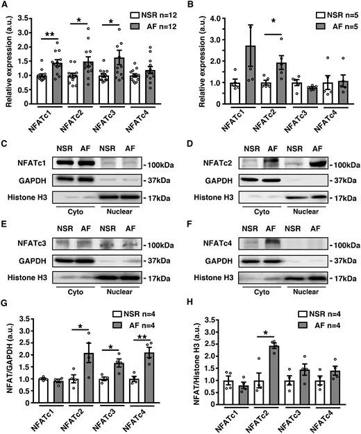 同济医学院附属同济医院倪黎教授等揭示NFAT通路在房颤中的作用机制_医学界-助力医生临床决策和职业成长