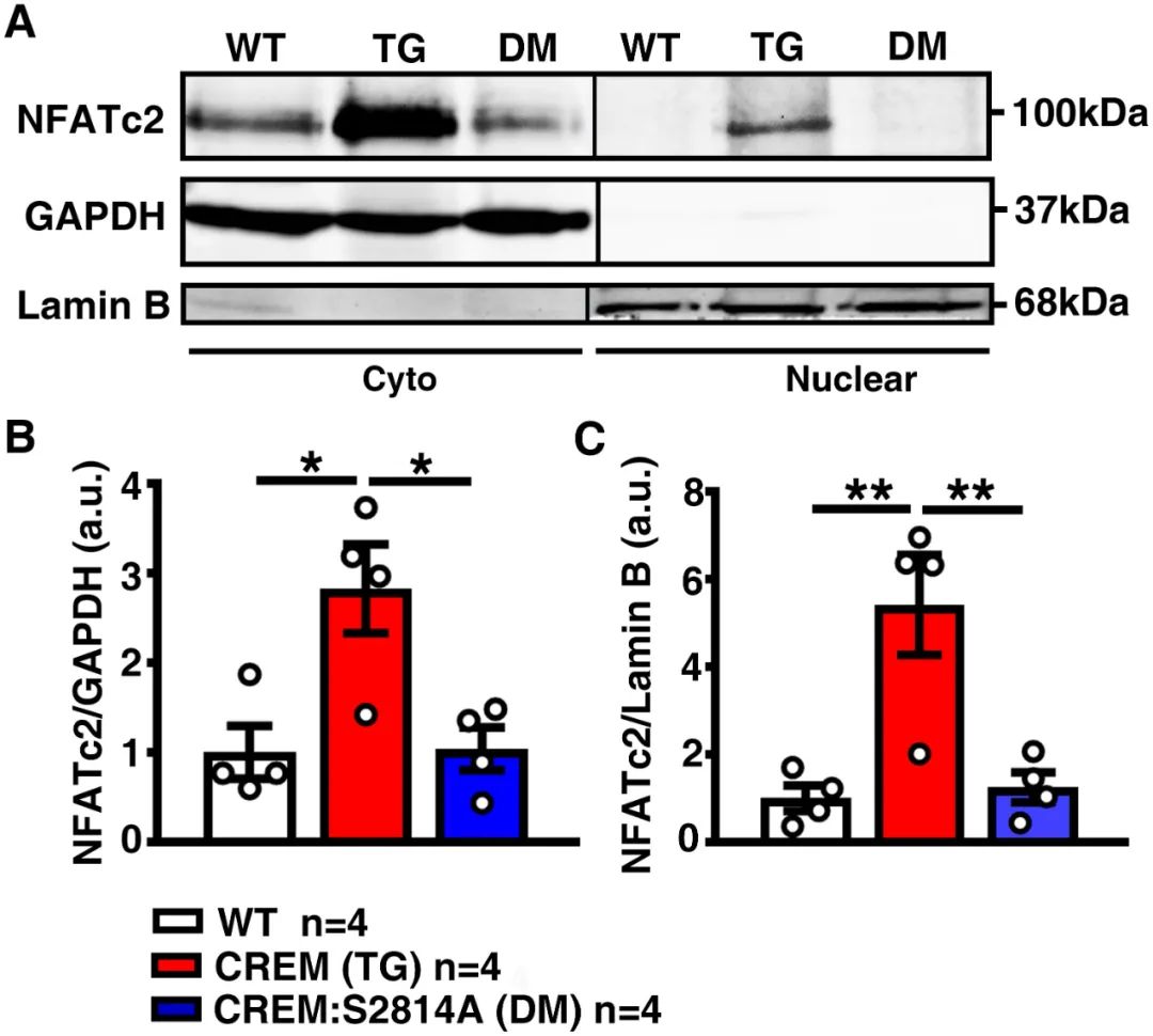 同济医学院附属同济医院倪黎教授等揭示NFAT通路在房颤中的作用机制_医学界-助力医生临床决策和职业成长