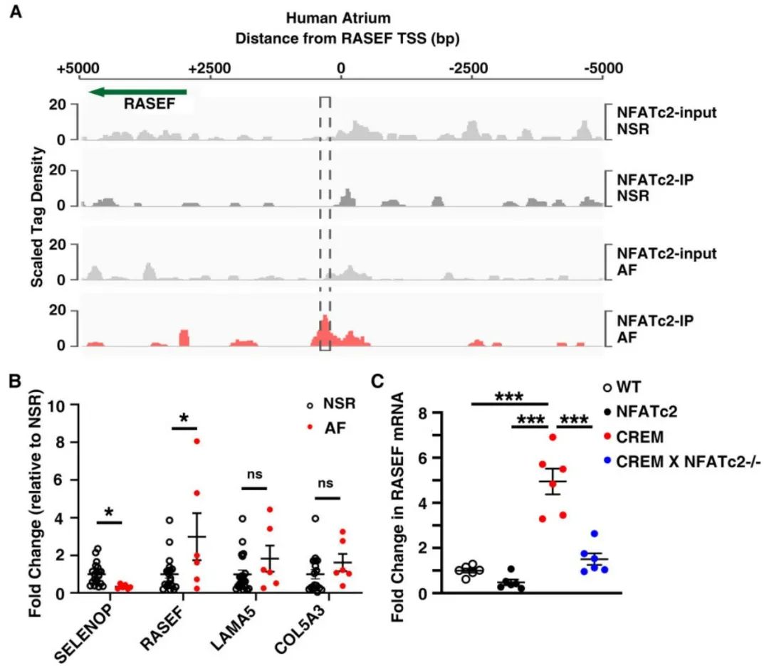 同济医学院附属同济医院倪黎教授等揭示NFAT通路在房颤中的作用机制_医学界-助力医生临床决策和职业成长