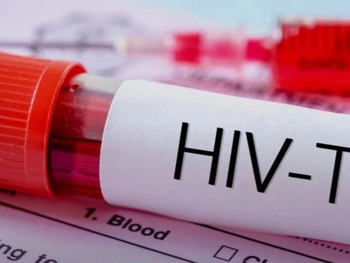 每日一练：该患者HIV感染临床分类的类别和级别是？_医学界-助力医生临床决策和职业成长